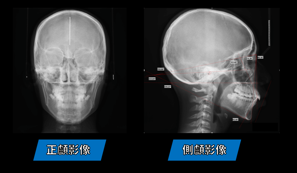 放射師這樣說：拍攝 X光 的重要性！ 牙齒大小事｜竹北品悅牙醫